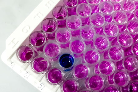 Matrigel Dome Assay And Drug Screening Of Colorectal Cancer Organoids