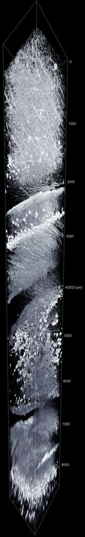 Olympus SCALEVIEW Microscope Objective Allows Imaging 8mm Deep ...