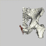 Image of the Year Awarded to Cytogen's Rotating Prostate