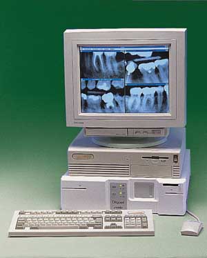 Digital Intraoral Imaging System