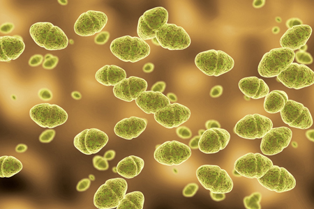 Why Lactococcus Lactis Might Be The Best Membrane Protein Factory