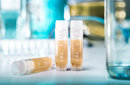 Is A Rapid Cooling Step Needed When Freezing Cells For Cryopreservation?