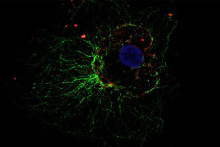 How To Prepare Your Specimen For Immunofluorescence Microscopy