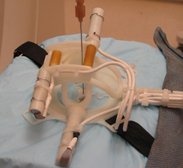 Robotic Biopsy System Drives The Point Home