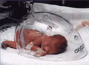 Nascor NICU Oxygen Hoods/Domes