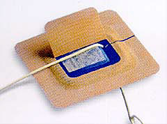 Percutaneous Drainage Catheter Fastener