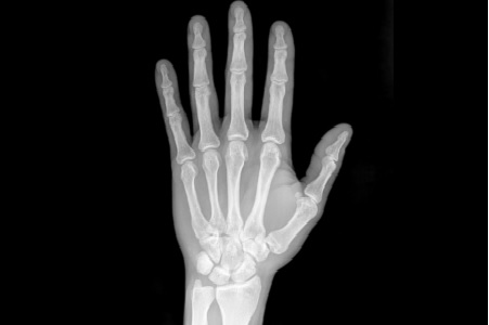 Radiation Exposure Avoiding Repetitive Exams And Raising Patient Awareness