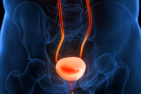 A Perfect Pair Combining Keytruda And mRNA Therapy To Optimize Bladder ...