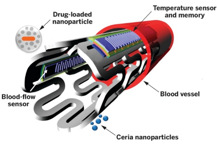 Scientists Incorporate Smart Technology Into Bioresorbable Stents