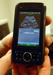 Ultrasound Imaging Now Possible With A Smartphone