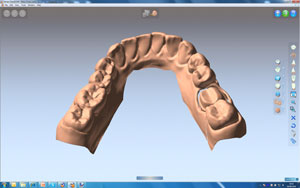 Delcam To Show High-Accuracy Dental CADCAM At BDTA Showcase