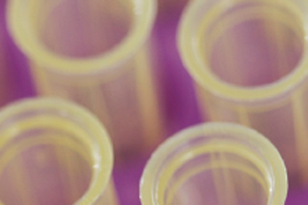 Flow Cytometry - From Discovery To Clinical Analysis