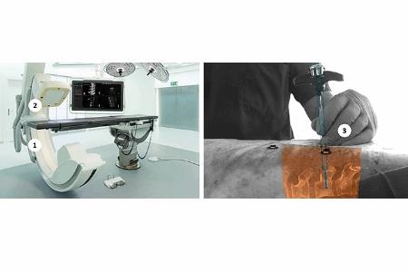 Philips Announces New Augmented-Reality Surgical Navigation Technology ...