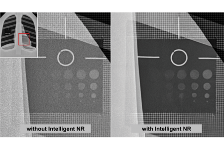 CMCU Digital Radiography Announces Technical White Paper On Intelligent ...