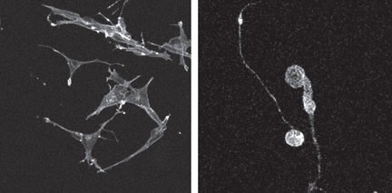 Growing Nerve Cells in 3-D Dramatically Affects Gene Expression