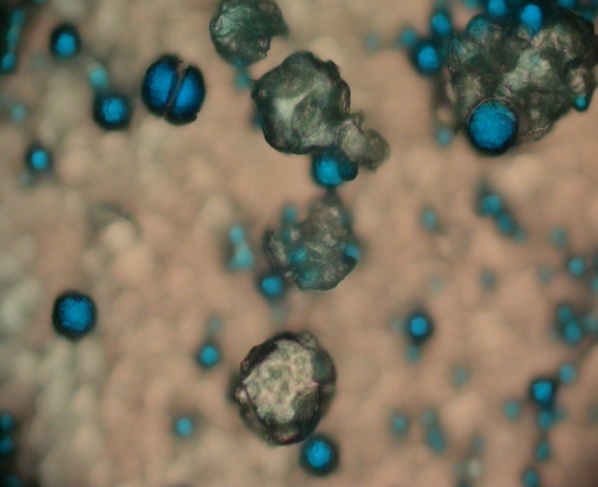 Cancer Targeted Treatments From Space Station Discoveries