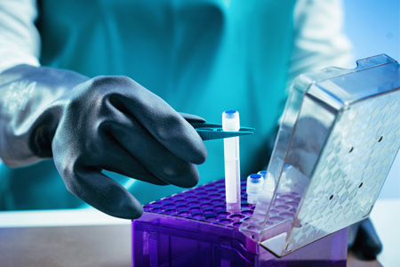 A Step-By-Step Guide To Cell Banking Preserving The Precious Potential ...