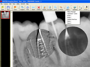 Adstra Imaging Introduces Predefined Filters