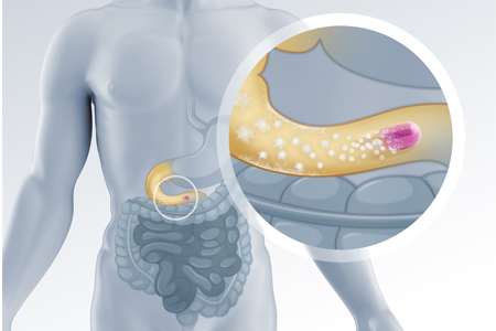 Enabling Enteric Protection And Rapid Release In The Upper Small Intestine