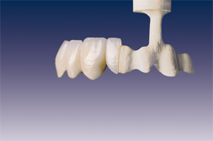 Invibio's PEEK-OPTIMA Polymer Provides A Platform For Dentanium's New ...
