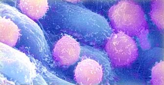 LigoCyte Receives $2.8 Million SBIR for Nanoparticle Anti-Inflammatories