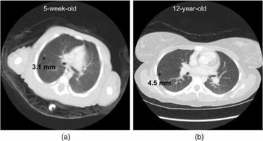 New App Assesses Radiation Dosage In Pediatric Imaging