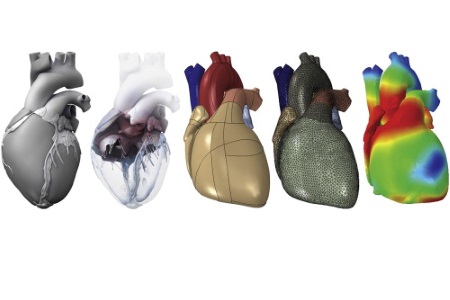Can Heart Simulations Enable Better Clinical Outcomes